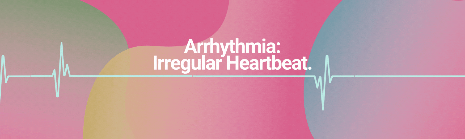 Arrhythmia- Rhythm Disorder - LifeCare Diagnostic Medical Centre